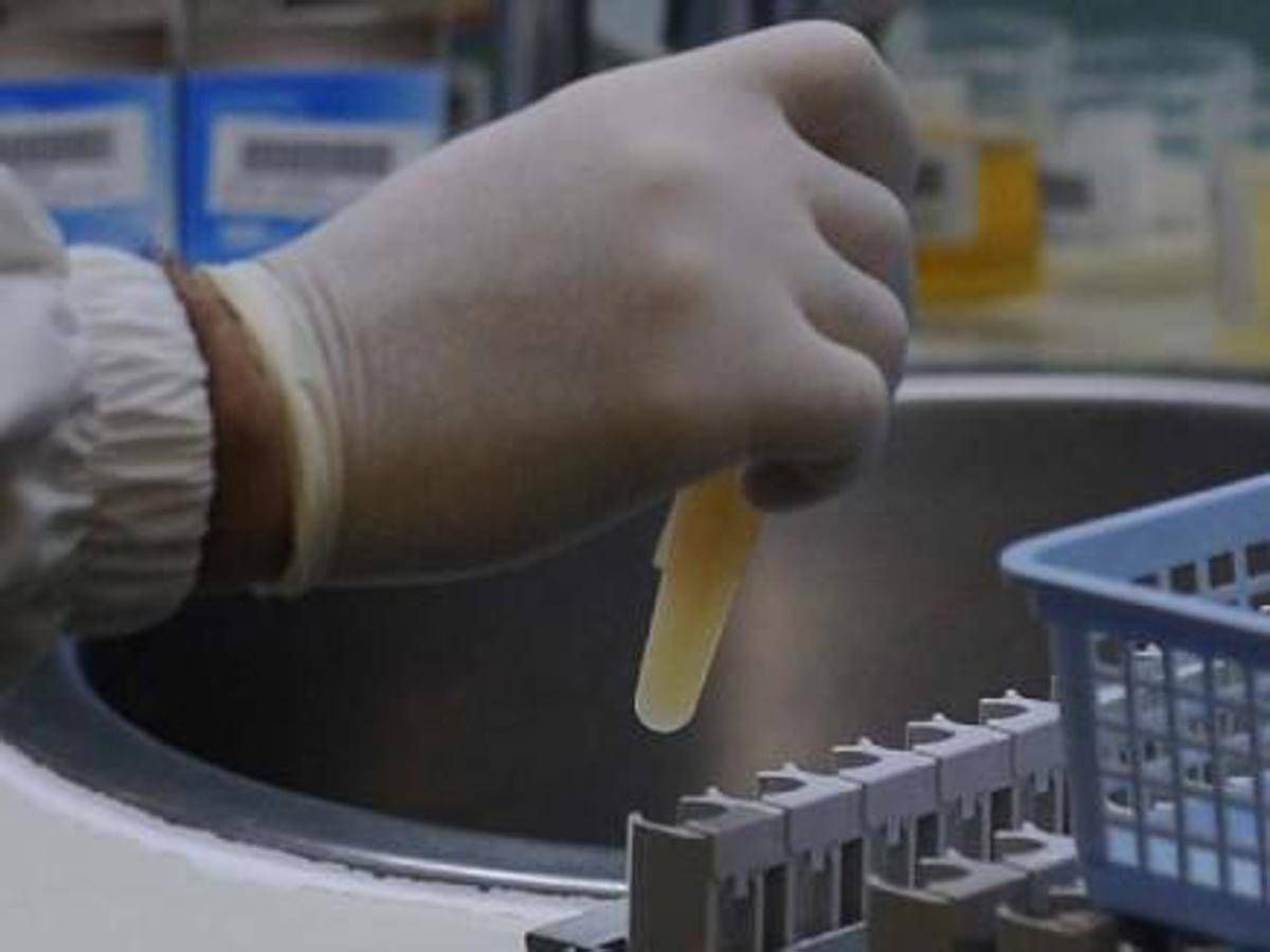 Tre morti per possibile focolaio di infezione da hantavirus su nave da ...